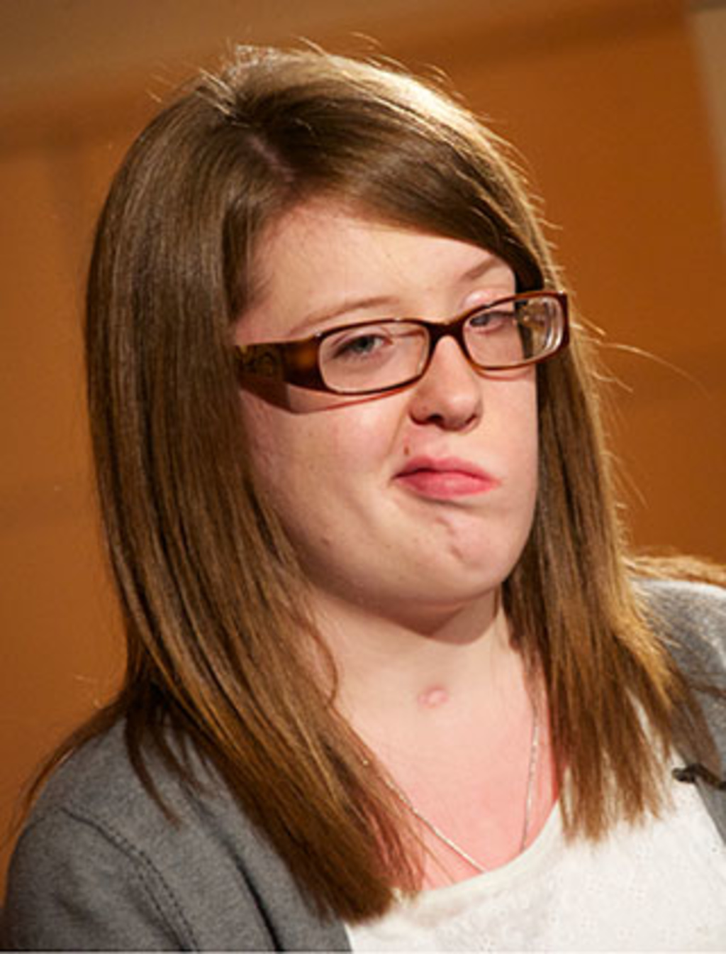 Reclaiming Natalie's smile | Iowa Now - The University of Iowa