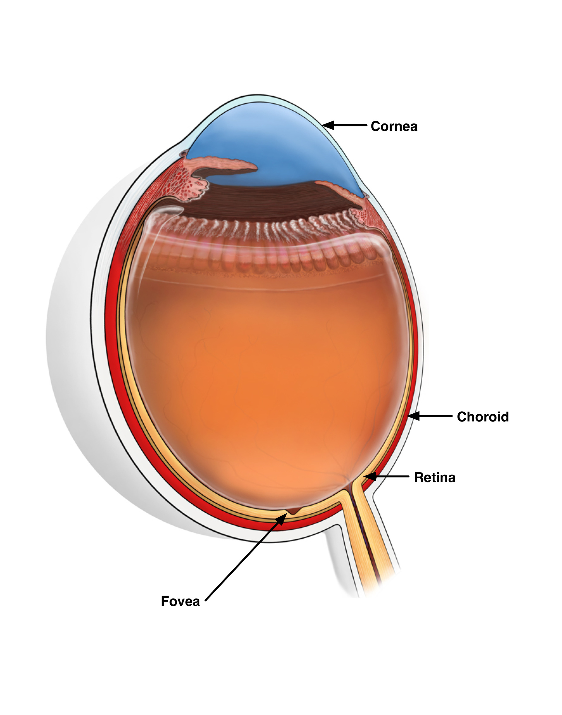 A map for eye disease | Iowa Now - The University of Iowa