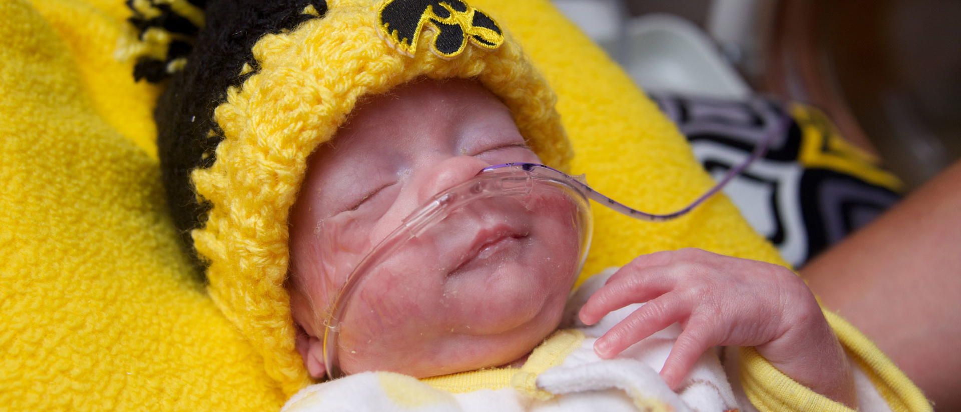 UI researchers: Lifesaving treatment for extremely preterm infants ...